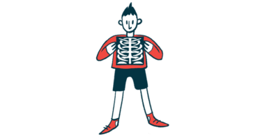 Venglustat Lowers Gb3 With No Signs of Disease Progression in Trial ...